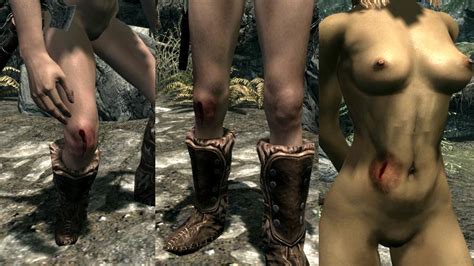 Injured Bodies And Faces Unp Mature Textures Page 2 Downloads