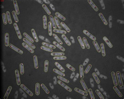 Simultaneous Segmentation Of Yeast Cells The Two Red Spots In Each Download Scientific Diagram