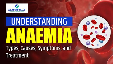 Understanding Anaemia Types Causes Symptoms And Treatment Academically