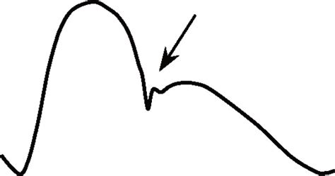 Central Hemodynamics For Management Of Arteriosclerotic Diseases Pmc