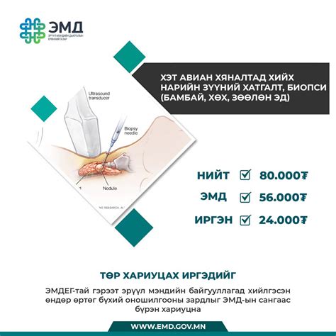 Эхоны зүүний хатгалт биопси шинжилгээний 70 хувийг ЭМД аас хөнгөлнө