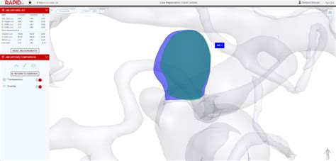 Pushing The Boundaries Of Cerebral Aneurysm Detection Monitoring And Care With AI