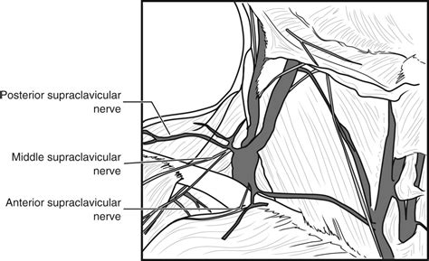Open Reduction And Internal Fixation Of Clavicle Fractures