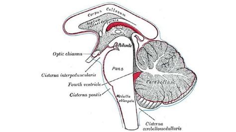 Cerebral Cisterns For Radiology Dnb Pptx
