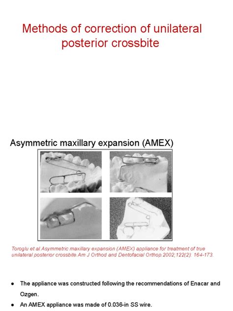 Methods Of Correction Of Unilateral Posterior Crossbite Pdf Dentistry Branches