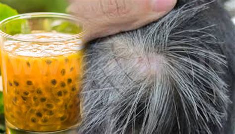 දරුවන්ගේ උණ වලිප්පු තත්ත්වයට පත්වීමේ අවදානම ඉහළට Hiru Tv Blog