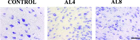 Images From The ACC Anterior Cingulate Cortex Illustrating The Download Scientific Diagram