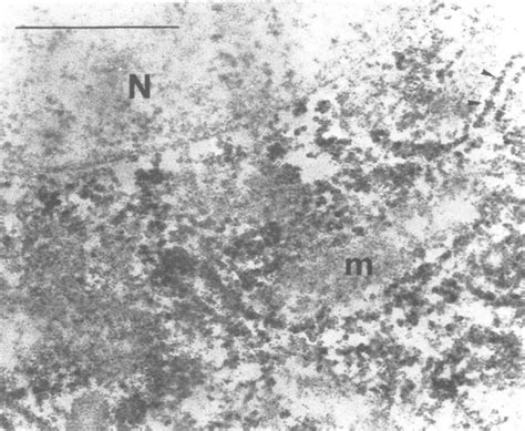 Electron Micrograph Of An Mdbk Cell Processed For Demonstration Of Download Scientific Diagram