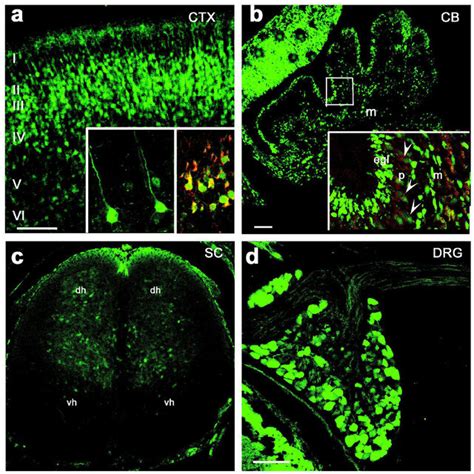 Yfp Expression In Homozygous And Heterozygous Mice Of The Two