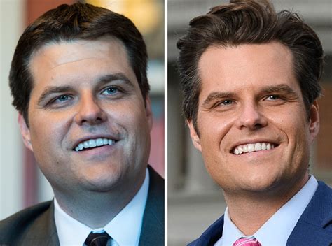 10 Mar A Lago” Face Transformations That Left People Utterly Stunned