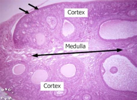 48 Pathology Of Ovary Nc Flashcards Quizlet