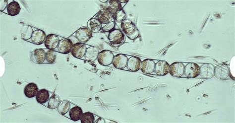 A Critical Arctic Organism Is Now Infested With Microplastics Wired