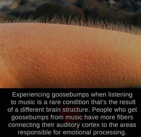 Experiencing Goosebumps When Listening To Music Is Rare Condition That