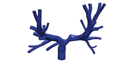 Obj File 3d Model Of Pulmonary Arteries Fontan Procedure ・3d Printable