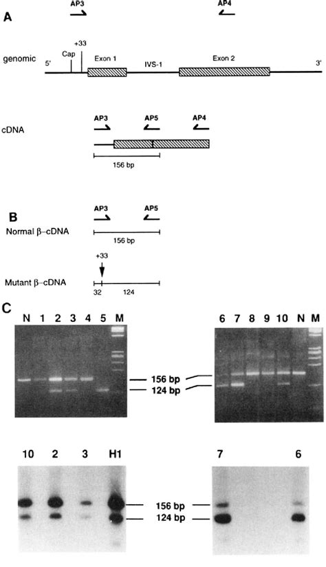 Figure 1 From Moderate Reduction Of Beta Globin Gene Transcript By A Novel Mutation In The 5