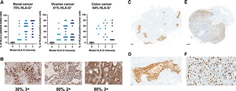 Jnj 78306358 A First In Class Bispecific T Cell Engaging Antibody Targeting Cd3 And Hla G Iscience