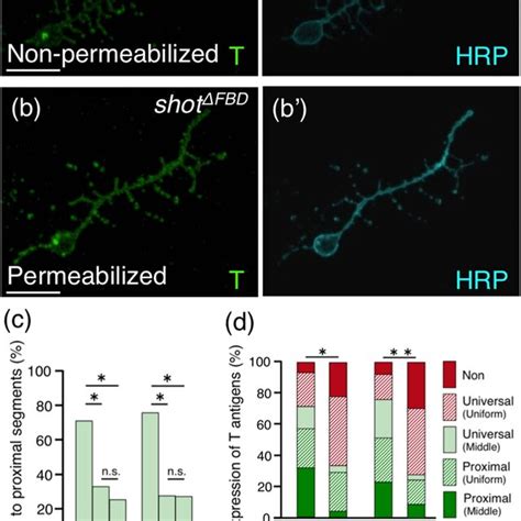 F Actin Binding Domain Of Shot Is Required For Proximal Localization Of