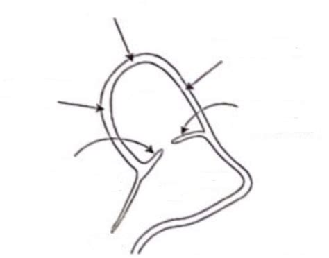 Parasternal Long Axis Of The Right Ventricle Diagram Quizlet