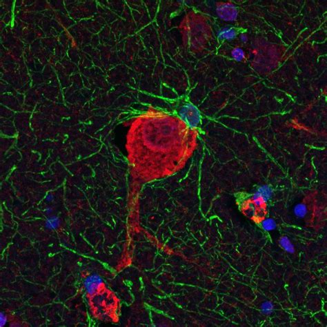 Christ This Stunning Image Displays Cells Of The Brain Including Astrocytes Labelled In