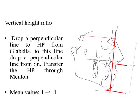 Mandibular Deformities And Their Management Pptx