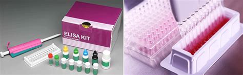 What Is Elisa And Its Principle Antiteck