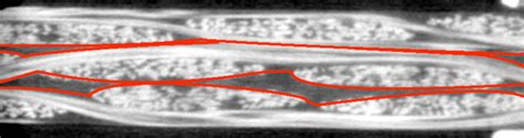 The Matrix Rich Zones Seen In A Cross Section Of A Specimen Taken Via