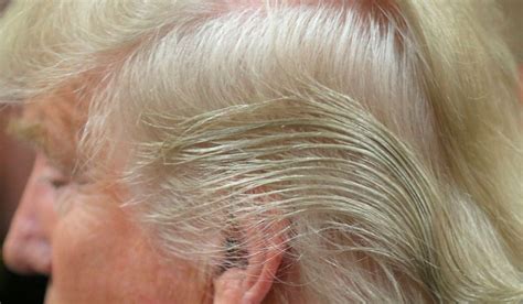 Side Effects Of Finasteride Dhi Panamá