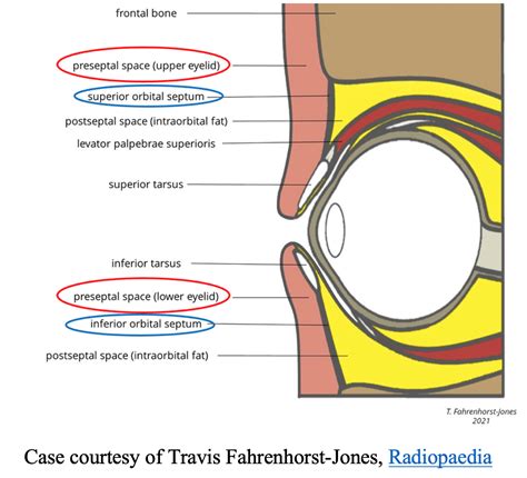 Em3am Periorbital Cellulitis Emdocs