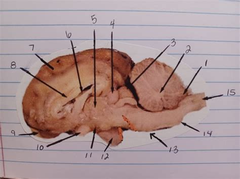 Sheep Brain Flashcards Quizlet Sheep Brain Flashcards Quizlet