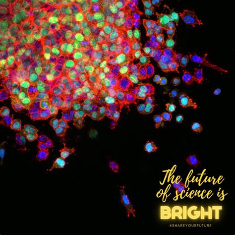 Aaron Hudson On Linkedin Precisionmedicine Shareyourfuture