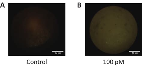 Dna Virus Detection System Based On Rpa Crisprcas12a Spm And Deep