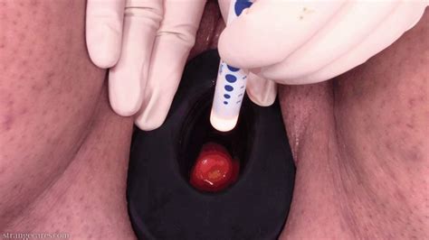 Cervix Swabbed With Iodine Strangecares Clips4sale