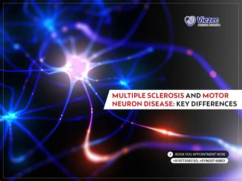 Differences Between Multiple Sclerosis And Motor Neuron Disease