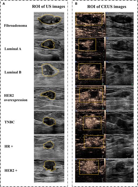 Image Segmentation A Schematic Diagram Of Cus Images B Schematic Download Scientific