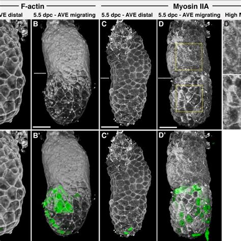 F Actin And Myosin Iia Localisation At Different Stages Of Ave Download Scientific Diagram