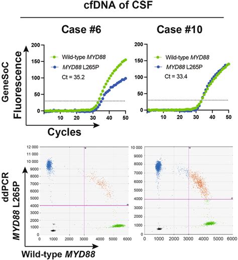 Rapid Detection Of The Myd88 L265p Mutation For Pre‐ And Intra