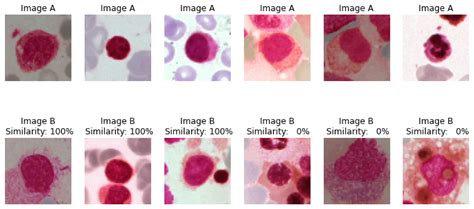 diagnostics free full text automated bone marrow cell classification for haematological