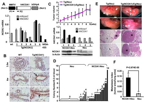Ncoa1 Directly Targets M Csf1 Expression To Promote Breast Cancer