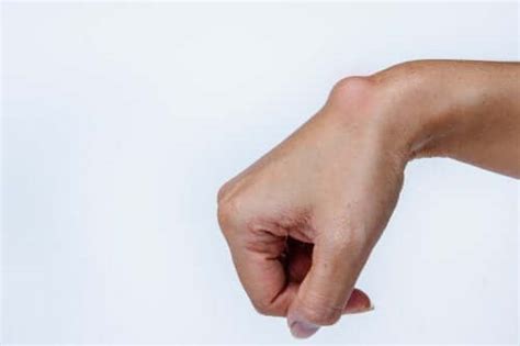 Whats The Difference Between A Cyst And A Tumor Step To Health