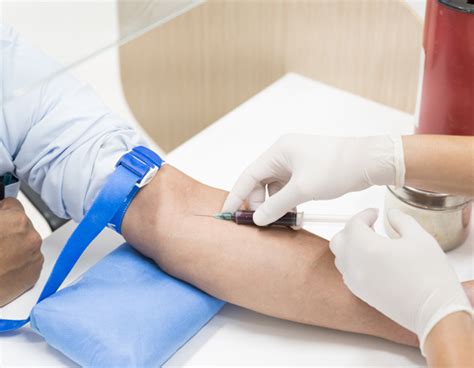 Баланит что это Лечение симптомы причины и виды заболевания