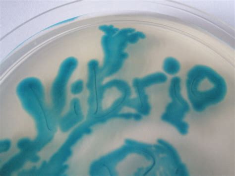 Agar CromogÉnico Para Vibrio