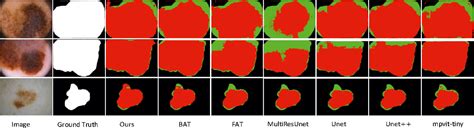 Figure From Enhancing Skin Lesion Segmentation With A Fusion Of Convolutional Neural Networks