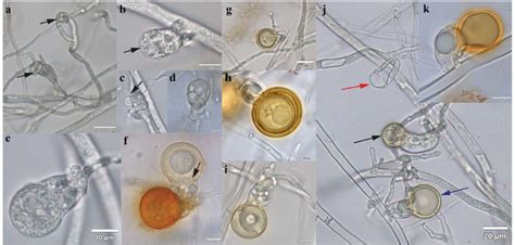 Sexual Morphogenesis In Phytophthora Palmivora UQ3694 A1 And UQ3746 Download Scientific