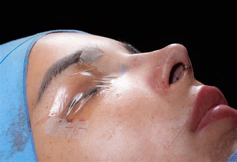 My Sex Life Sizzles After Plastic Surgeries In One Day