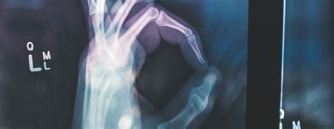 An Explainable Deep Learning Model In Keras Medium