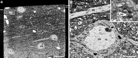 Neuron Electron Microscope