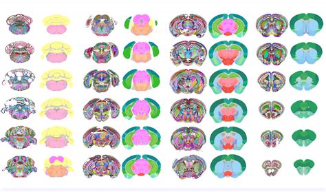 Ai Model Built On Transformer Architecture Maps 1300 Mouse Brain