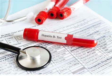 Anti Hepatitis B Surface Antigen Total