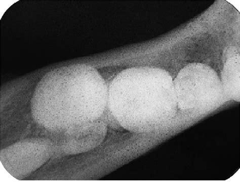 Paramolar Semantic Scholar