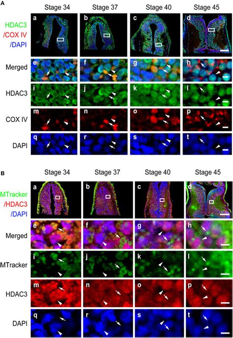 Subcellular Distribution Of Hdac3 In The Developing Tectum A